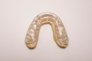 Night Guards and Sports Guards in Ottawa - Watersedge Dental Laboratory ...