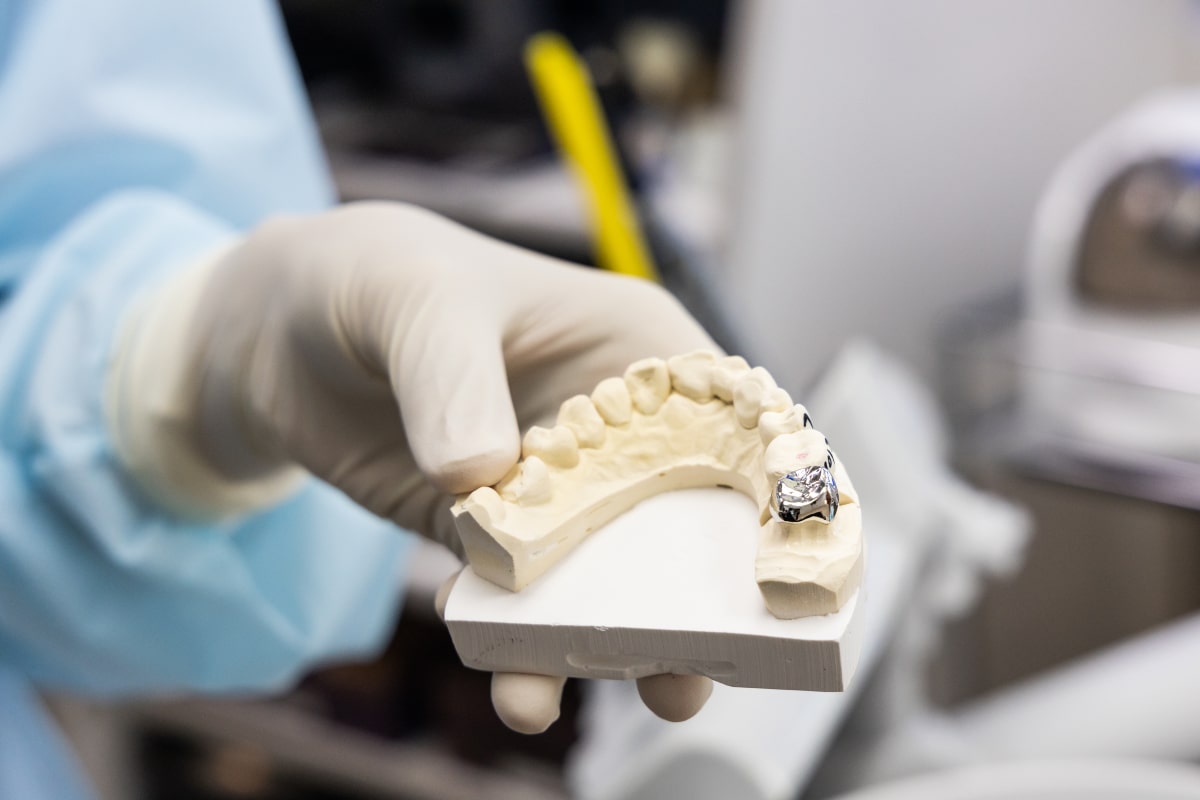 Crowns and Bridges Lab In Ottawa - Watersedge Dental Laboratory Inc.
